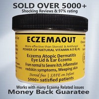 Natural Dyshidrotic eczema cream non | Offer of the day