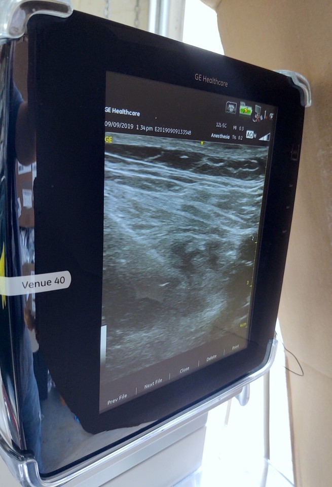 GE Venue 40 Portable Vascular Access Ultrasound Machine w/ 12L-SC Probe ...