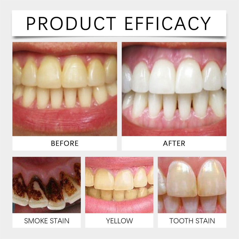 Toothpaste For Cleaning 120g Stain Removing Teeth Cleaner Toothpaste ...