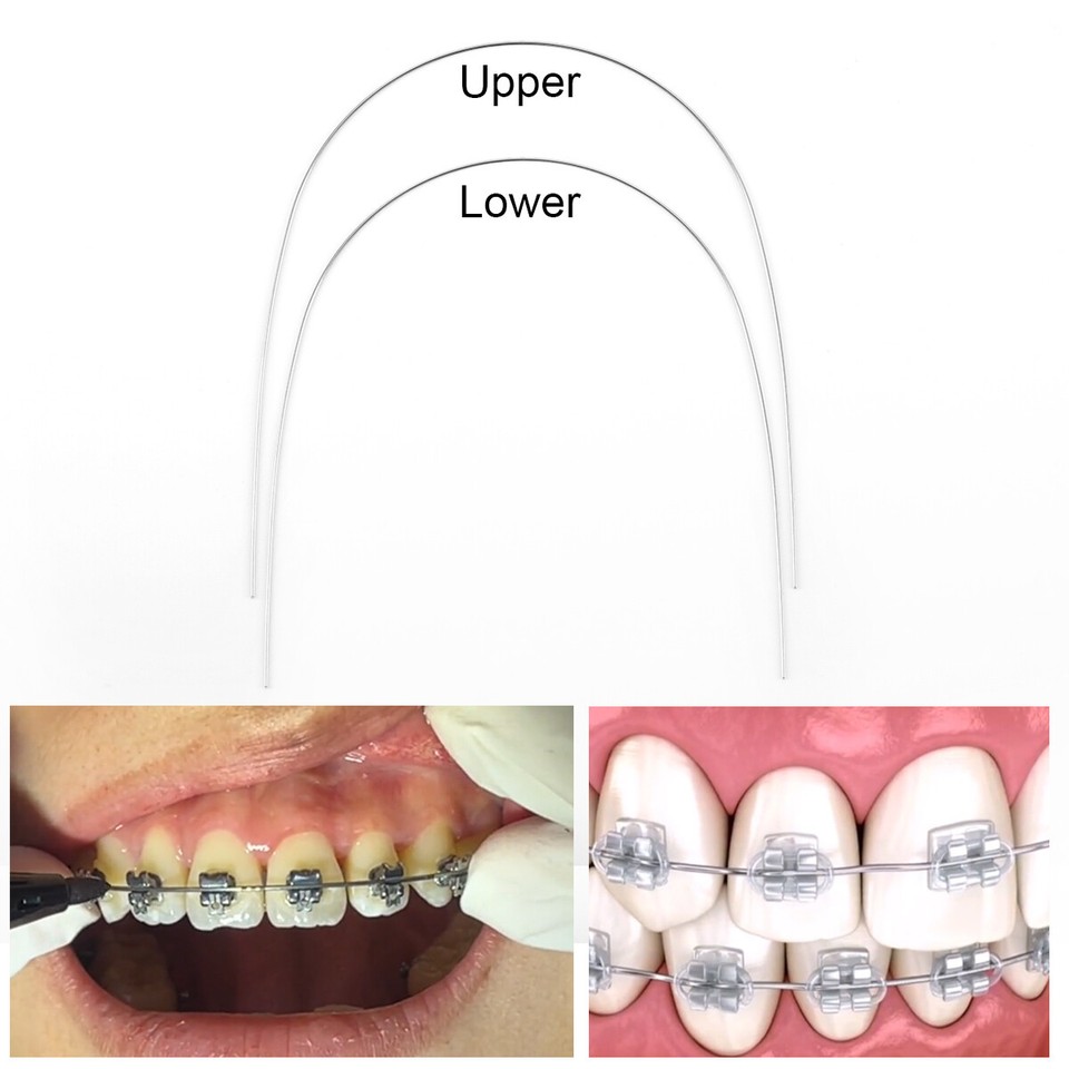 AZDENT Dental Ortho Braces Brackets Mini Roth MBT /Niti Super Elastic ...