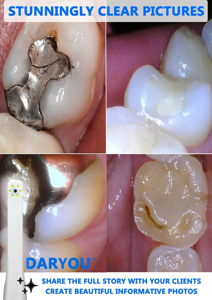 DARYOU DY-50 Intraoral Intra Oral Dental Camera Button Work ExaminePro ...