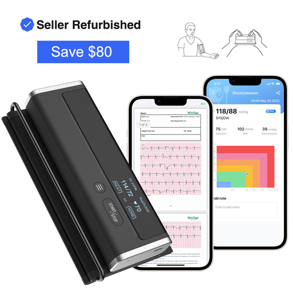 BP2 WiFi Blood Pressure Monitor 30s/60s/90s/120s Spot Checking w AI EKG ...