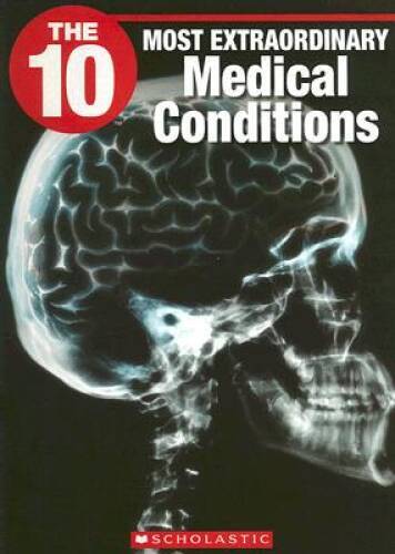 The 10 Most Extraordinary Medical Conditions (Ten) - Paperback - GOOD ...