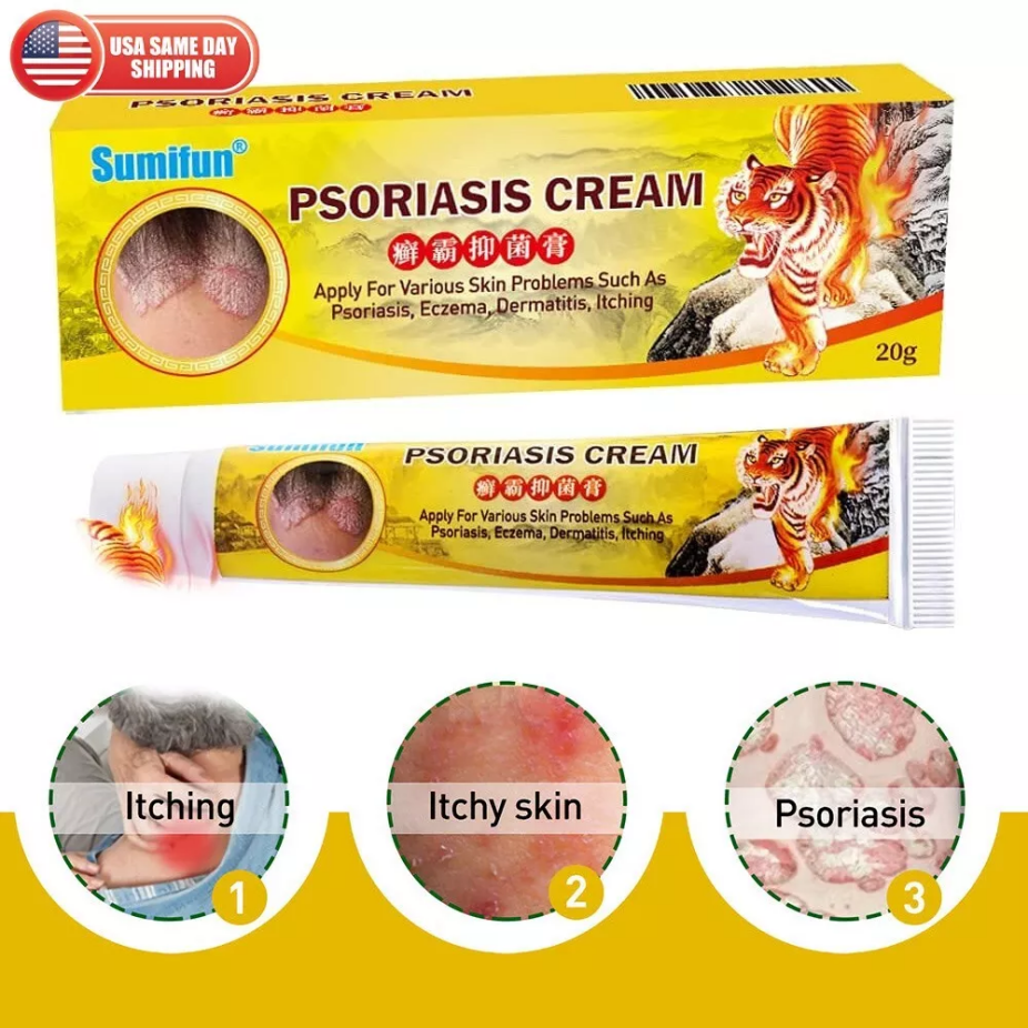 Health Care Psoriasis Cream Eczema Ointment Scalp Psoriasis Hand Tinea ...