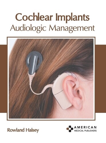 Cochlear Implants: Audiologic Management (Hardback) (UK IMPORT) | eBay