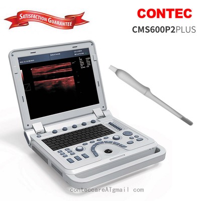 Imaging & Aesthetics Equipment - Transrectal Probe
