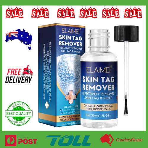 Fast Skin Tag Remover Instant Treatment Safe Wart Acne Removal Face ...