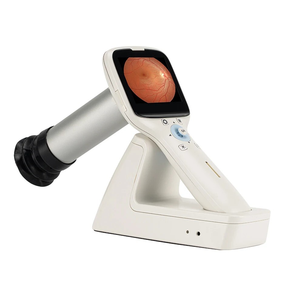 Fully Automated Portable Retinal Imaging SystemHandheld Fundus Camera ...