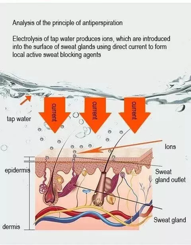 Hyperhidrosis Machine Iontophoresis Against Stop Hands and Feet ...