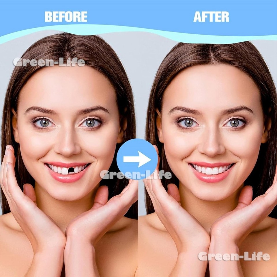 New Snap On False Teeth Upper + Lower Dental Veneers Dentures Tooth ...