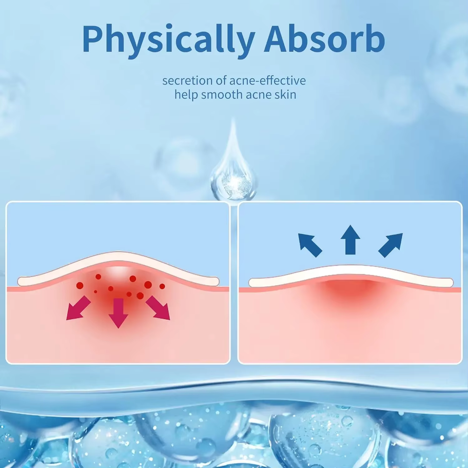 180/360PCS Invisible Acne Veneer Lump Sticker Reduce Acne Cleansing ...