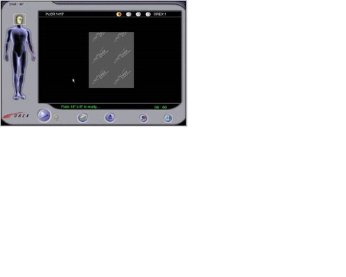 kodak orex pccr digital xray cr reader | eBay