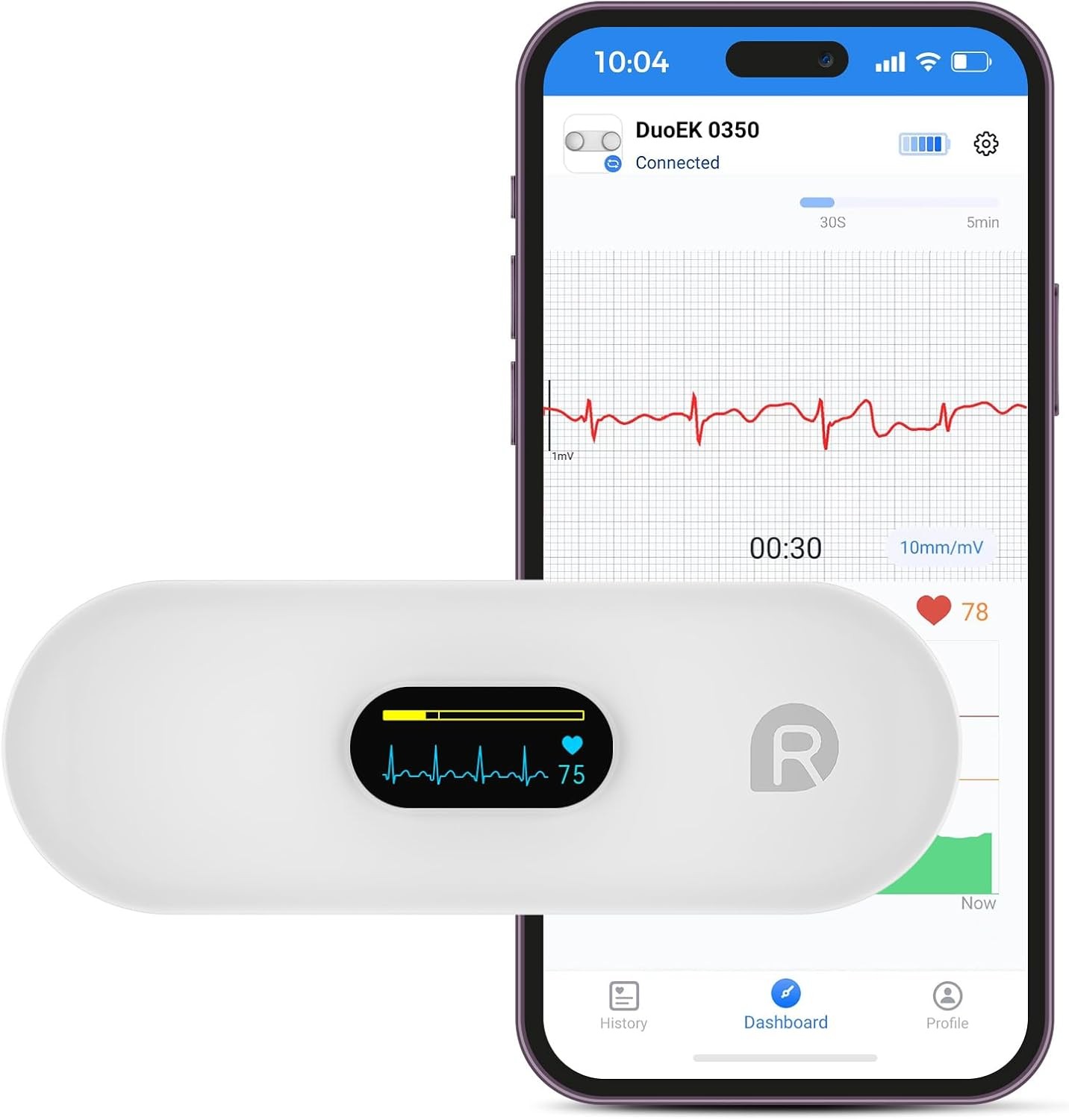 Portable Heart Rate Monitor, Wireless Home Use Heart Rhythm Tracker, Heart Monit | eBay