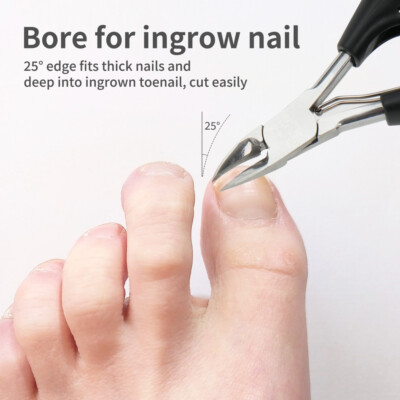 Professional Podiatrist-Recommended Toenail Clippers with Large Opening ...