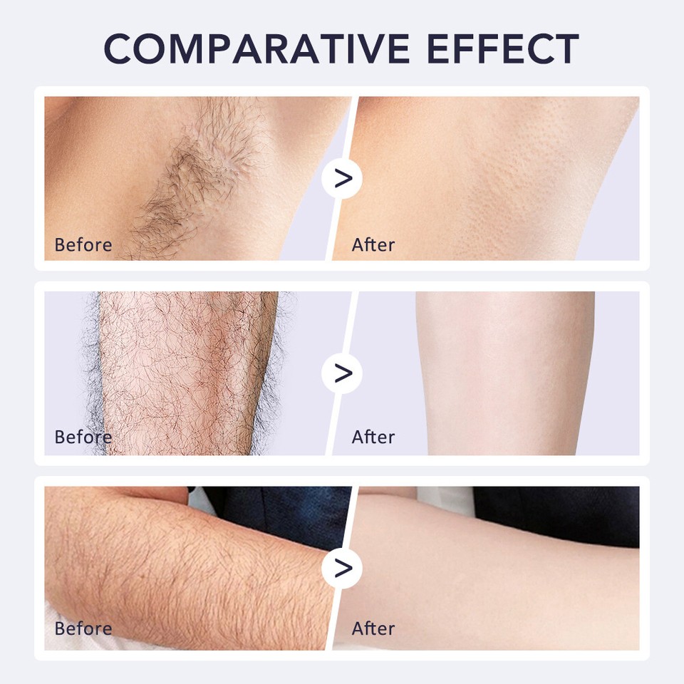 Strong Hair Removal Cream Permanent Stop Hair Growth Inhibitor Remover ...