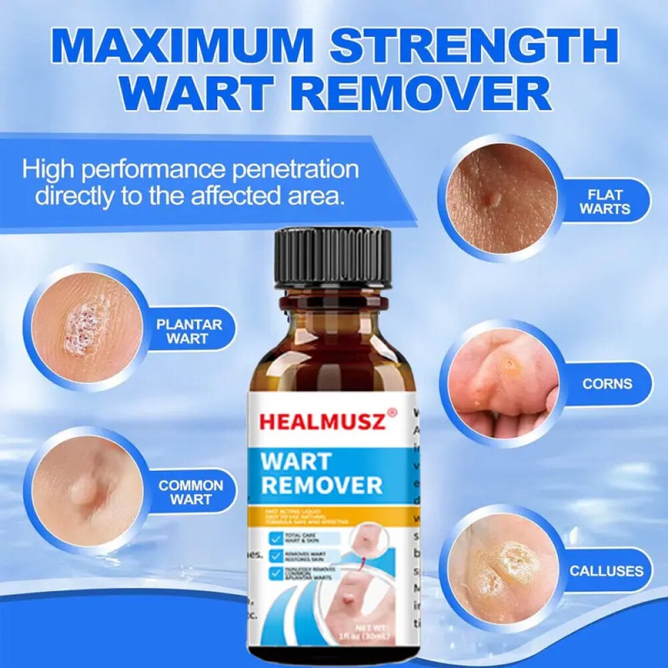 Wart Remover Liquid Skin Tag Mole Remover Eliminate Feet Corn Wart ...