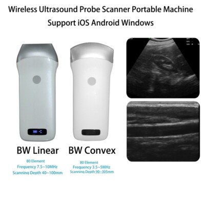 Wireless Ultrasound Probe Scanner Portable Machine Support iOS Android ...