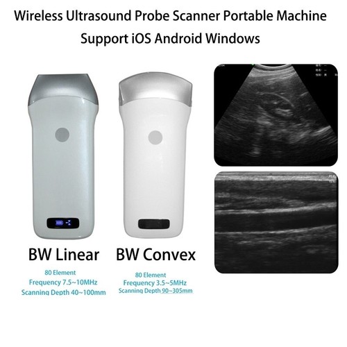 Wireless Ultrasound Probe Scanner Portable Machine Support iOS Android ...