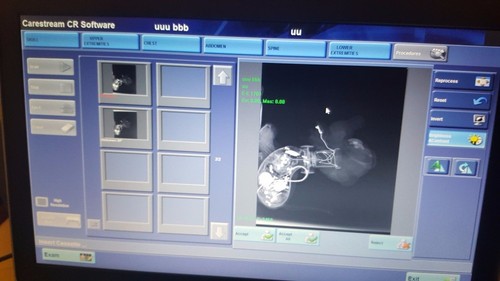 Vita CR xray carestream Digital X-Ray cr reader refurbished kodak cr ...