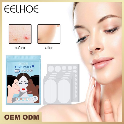 Pimple Patches Hydrocolloid Master Acne Spot Treatment Skin Tag Remover ...