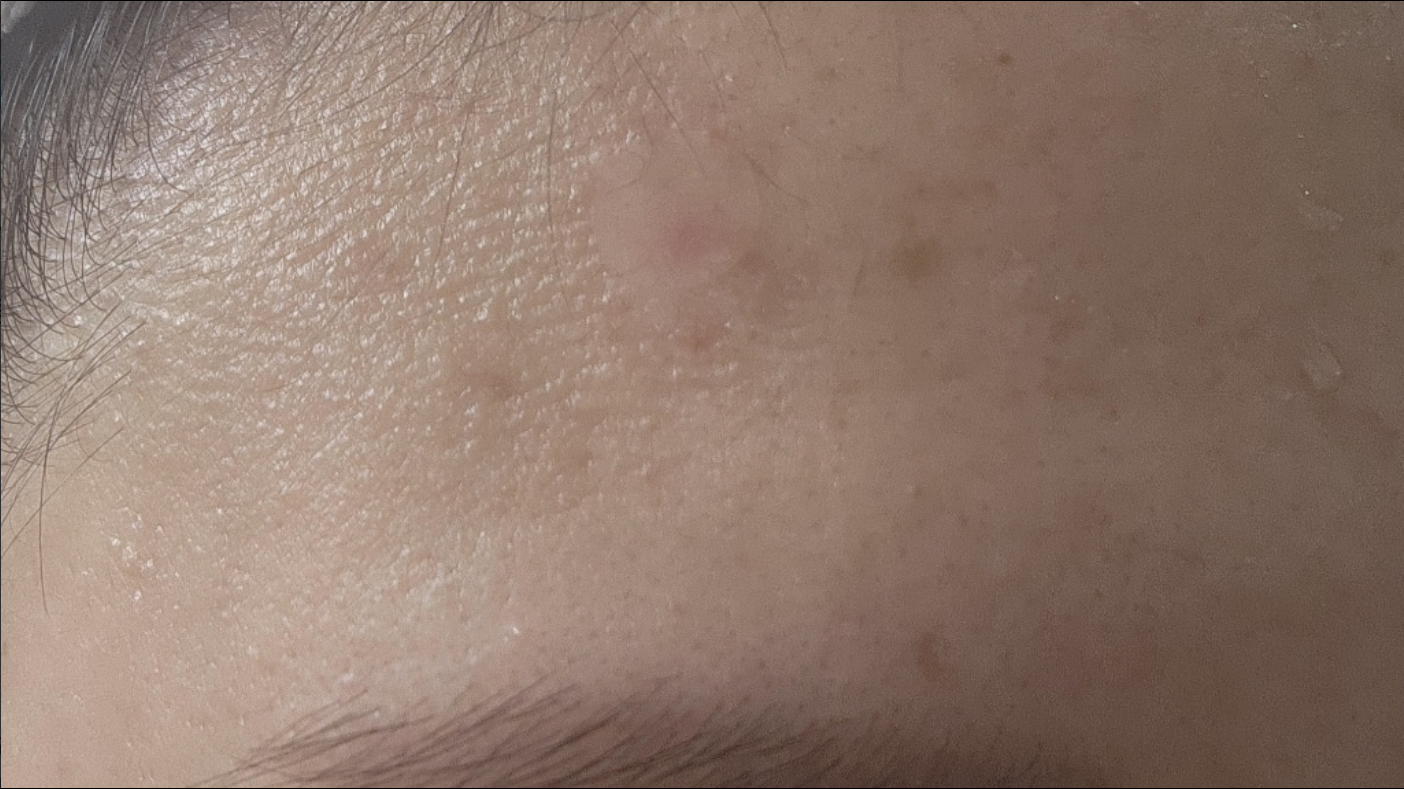 Spot Care Patch - 1 Kit (Red Spot 40ct + Yellow Spot 40ct) x 4EA ...