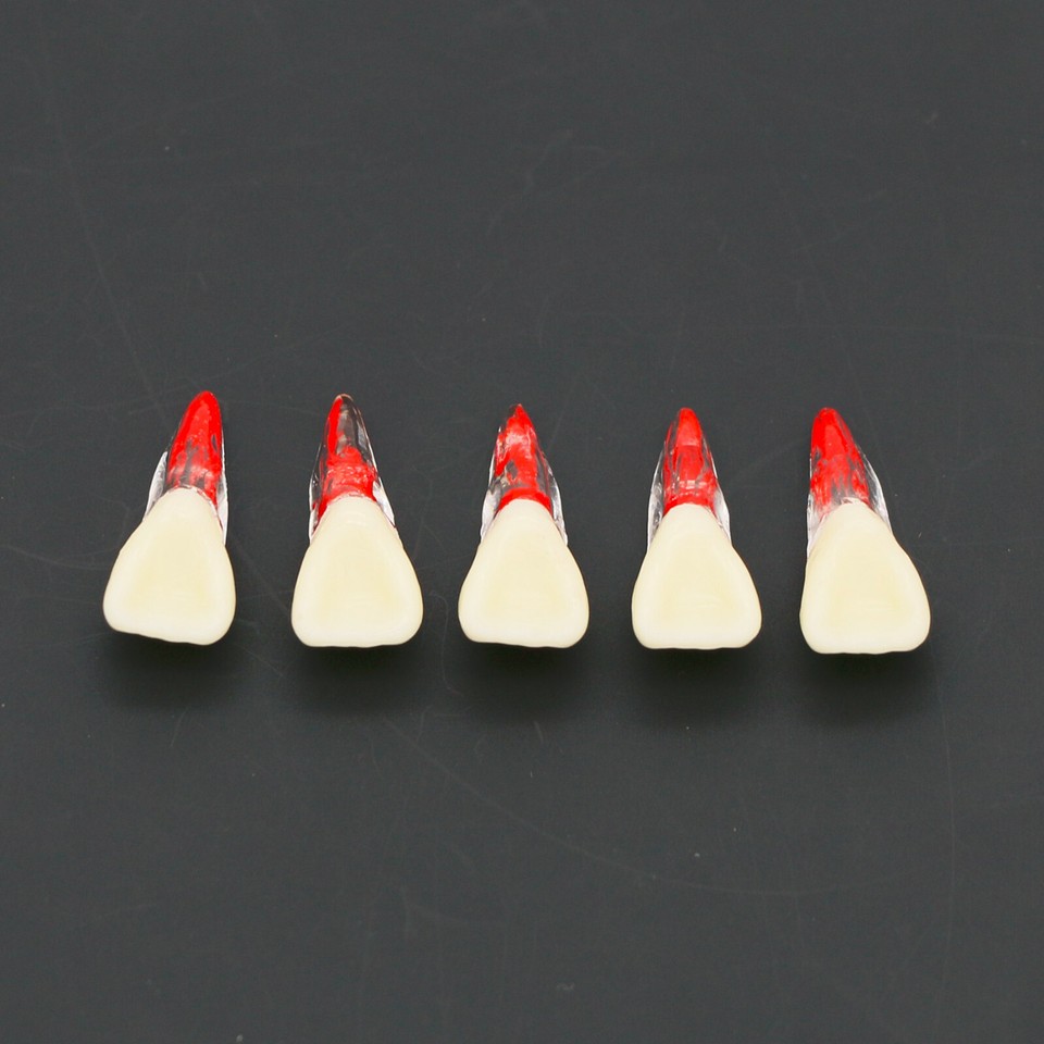 5Pcs Dental Endodontic Root Canal RCT Practice Pulp Cavity Endo Teeth ...