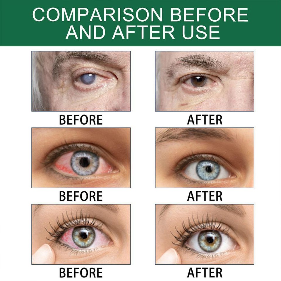 Presbyopia Vision Restore Eye Drops Relieve Fatigue Aningeresting Clean ...