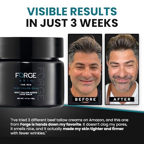 Forge Skin Men's Wrinkle Defense Beef Tallow Balm for Skin| Beef Tallow ...