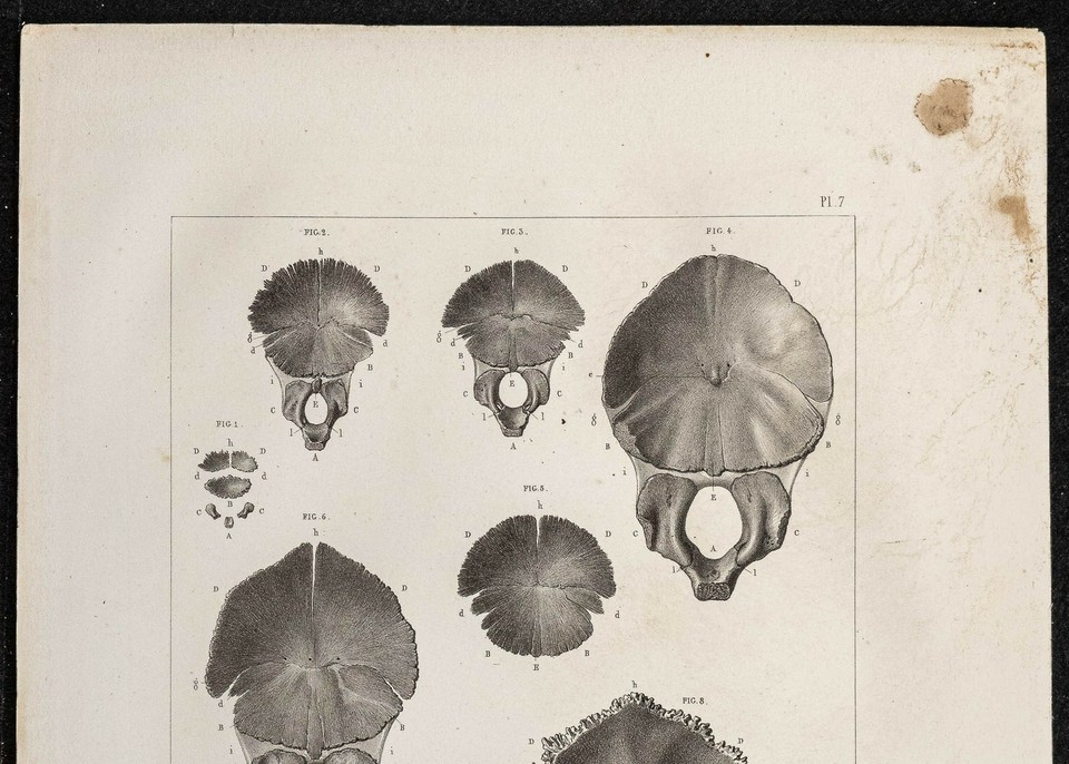 1864 - Occipital Bone Of The Skull - Anatomy Plate - Lithograph ...