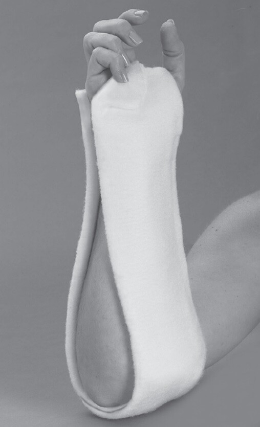 Sugar Tong - ReverseTong Arm Splint Kit | Materials make orthopedic ...