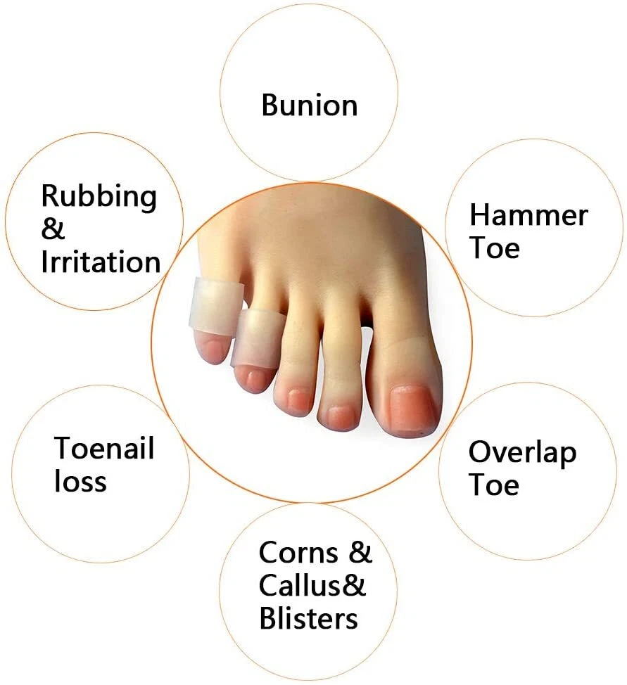 Pinky Toe Hammer Toe