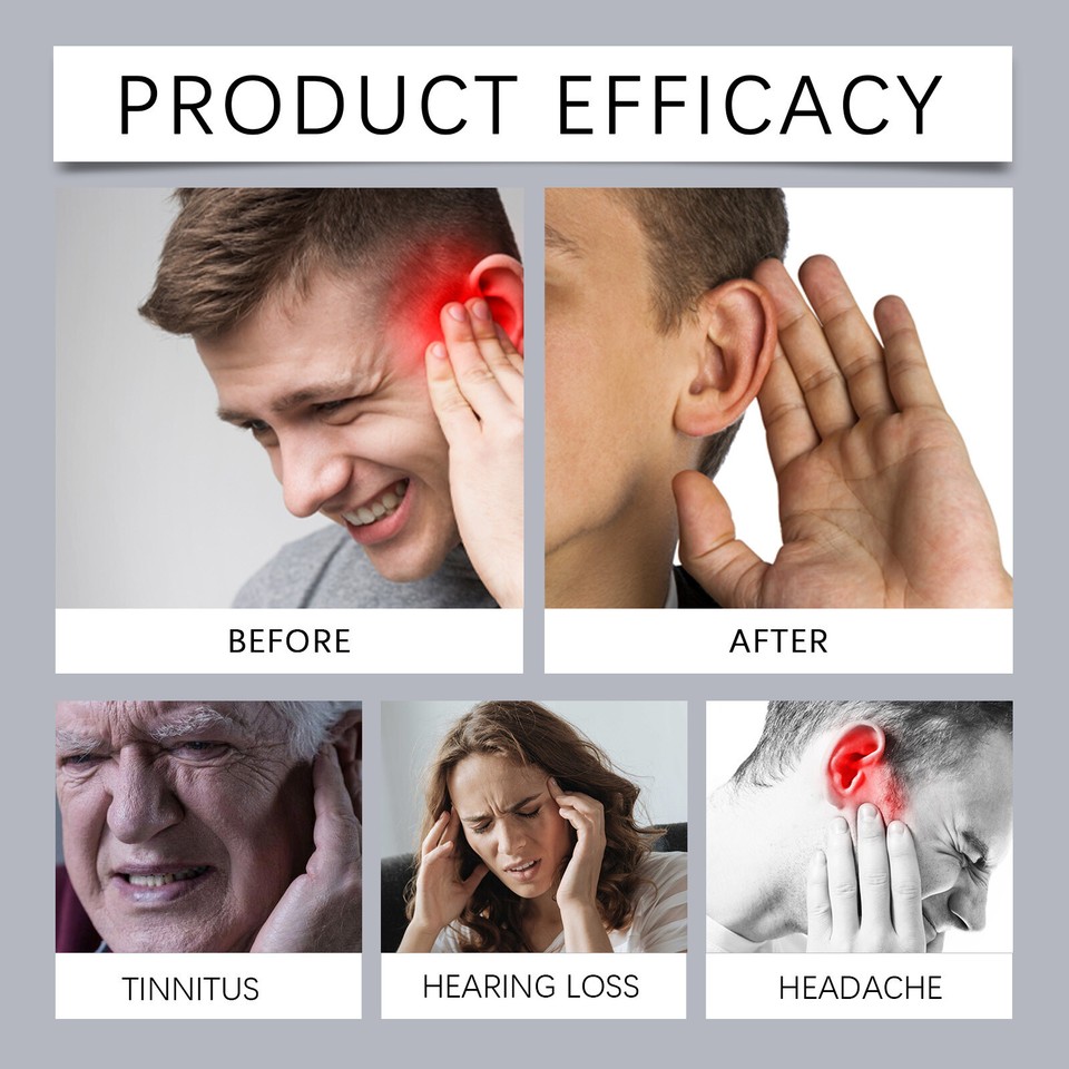 TinniEase Tinnitus Relief Cream, Tinnitus Relief for Ringing Ears, for ...