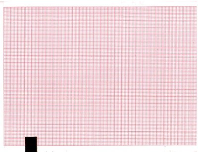 EEG Paper 110MM X 140MM X 142SHEETS (Works for FUKUDA OP-222TE, FX 7202 ...
