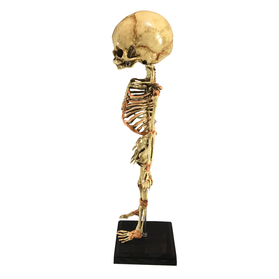 Aged Fetus Skeleton Medical Specimen Display Oddity Skull Bone ...