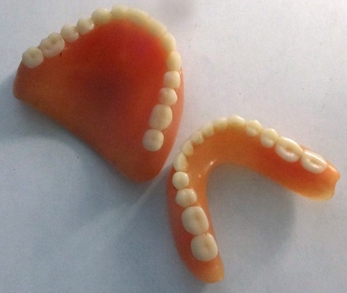 Vintage Lower and Upper Dentures False Teeth Display or Craft Use ...