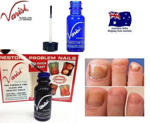 Varisi Restore NAIL Antifungal Fungal Toe treatment Finger Care Fungus ...