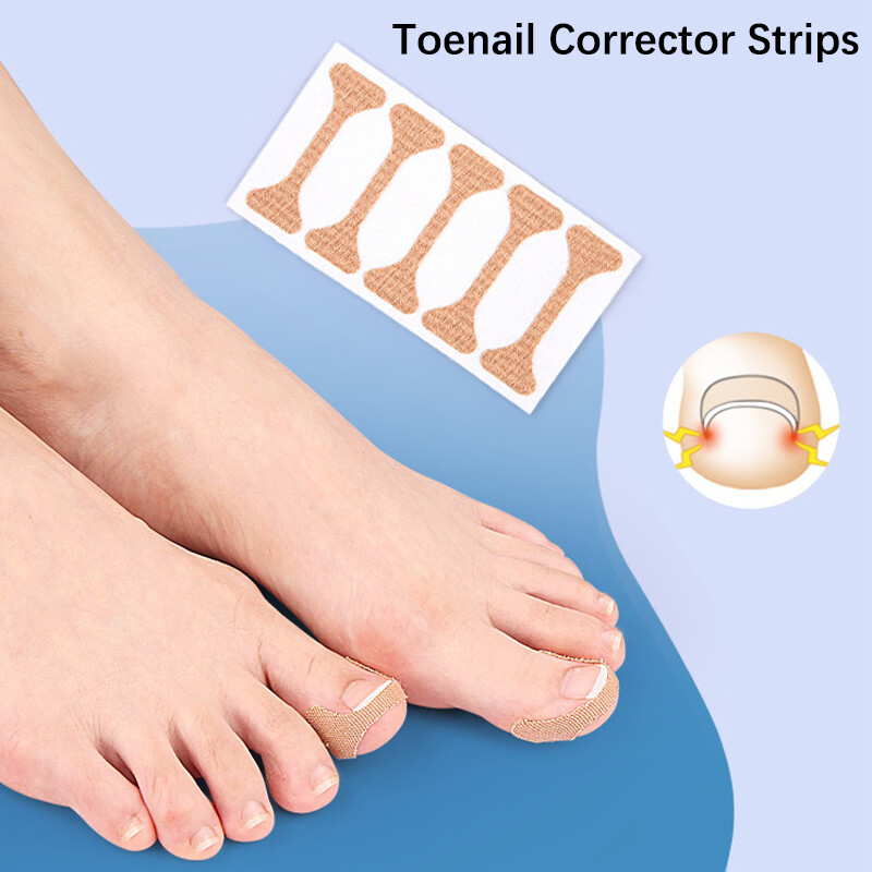 Toe Nail Repair Nail Correction Stickers Paronychia Treatment Ingrown ...