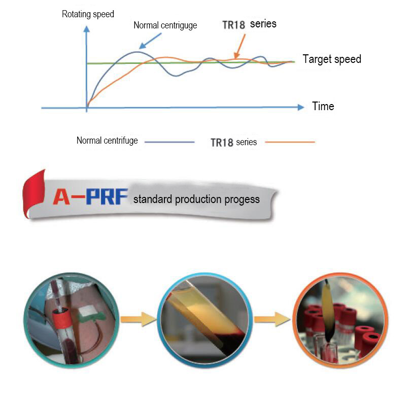 Stable Rotating speed PRF APRF IPRF oral centrifuge machine CE approved ...