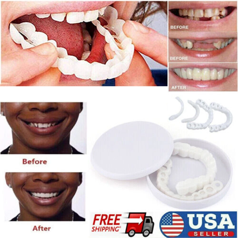 Removable Teeth Covers