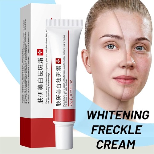 2 Pcs Freckle Cream, Acne Scar Removal Treatment Cream, Pigmentation ...