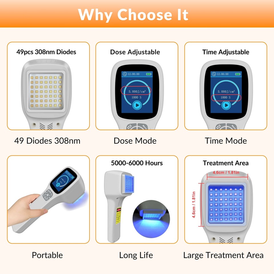 Household UVB Phototherapy 308nm Laser Excimer Treatment for Skin ...