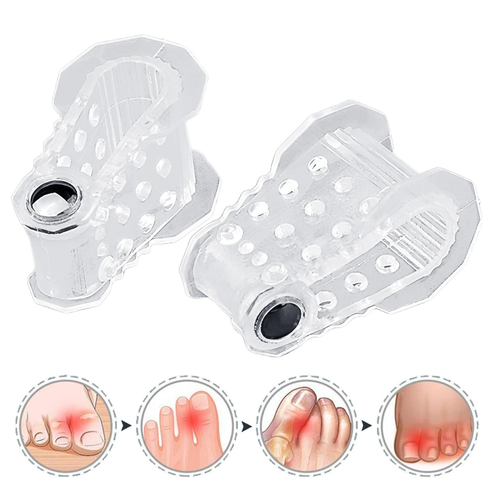 A-type magnetic toe divider thumb valgus orthosis toe pad overlap toe ...