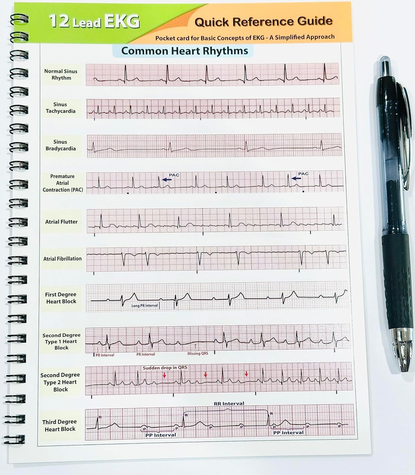12 Lead EKG Pocket Card | eBay