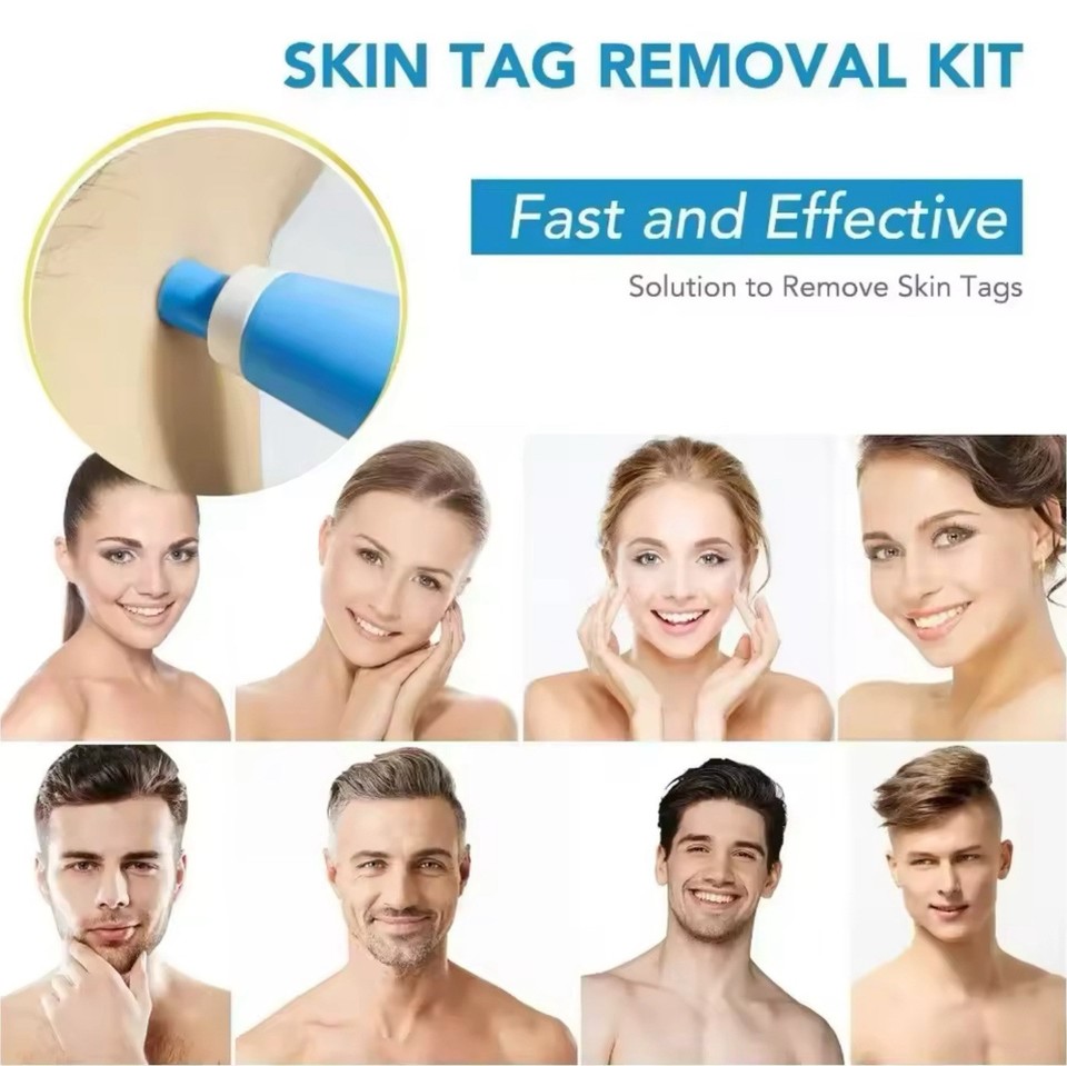 2-IN-1 Auto Skin Tag Removal Tool Kit Painless Skin Label Mole Acne ...