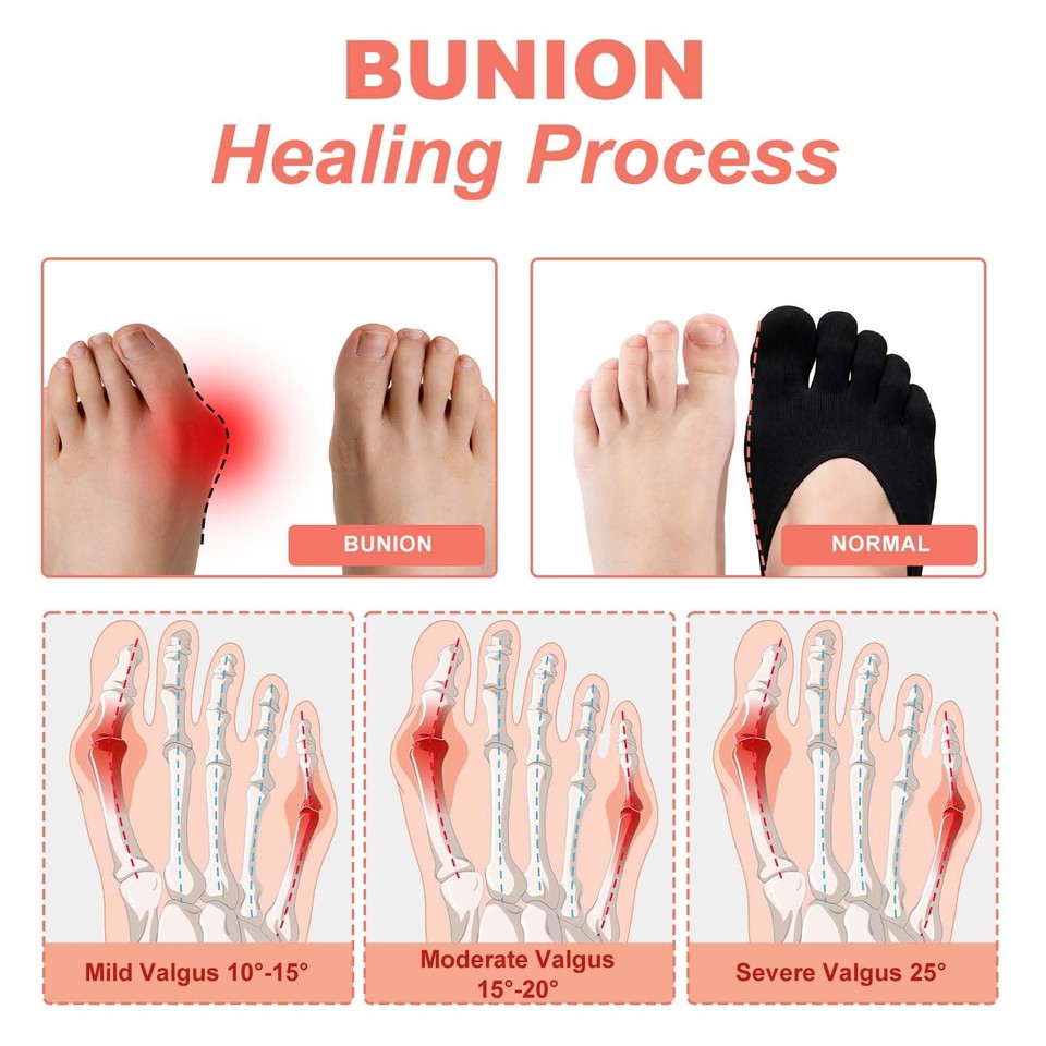 Women's 4 Pairs Orthopedic Toe Compression Socks, Toe Separator Socks ...