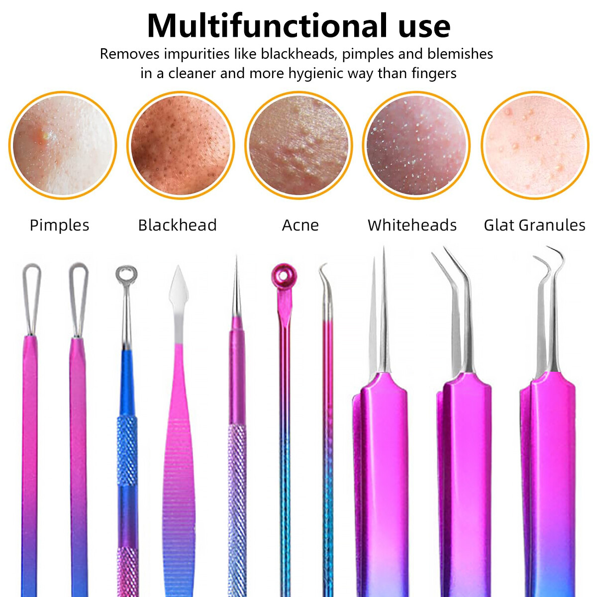 10pcs Blackhead Remover Tool Kit Stainless Steel Pimple Popper Tool ...