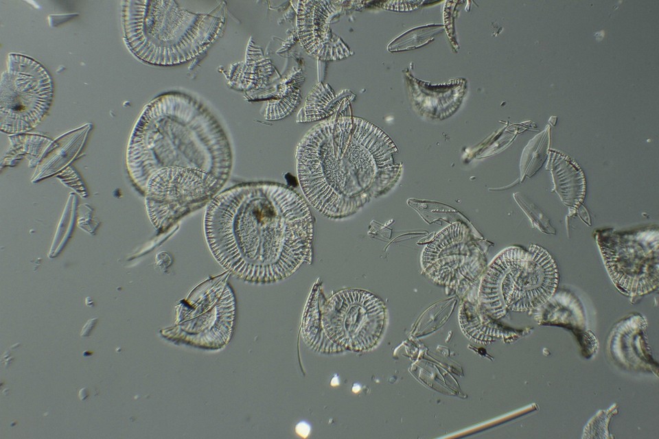 Antique Microscope Slide with Decorative Ringing. Diatom Strew | eBay