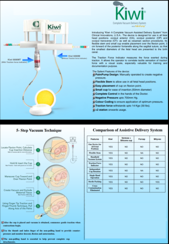 Vacuum Delivery Placement Operative Vaginal Birth — CREOGS Over