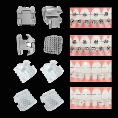 Orthodontic Self Ligating Bracket Metal Ceramic Damon Q Clear Brace ...