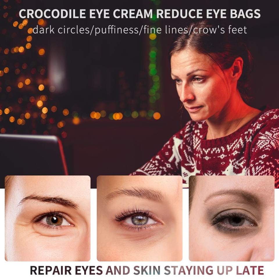 Magic Eye Cream-28 Seconds Instant Remove Eye Bags & Dark Circles & Eye ...
